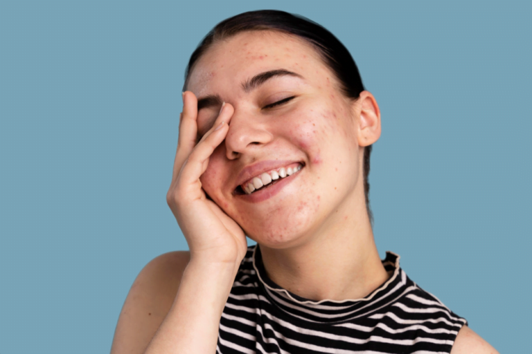 Chronic Skin Conditions - Dermatology Center of Northern California